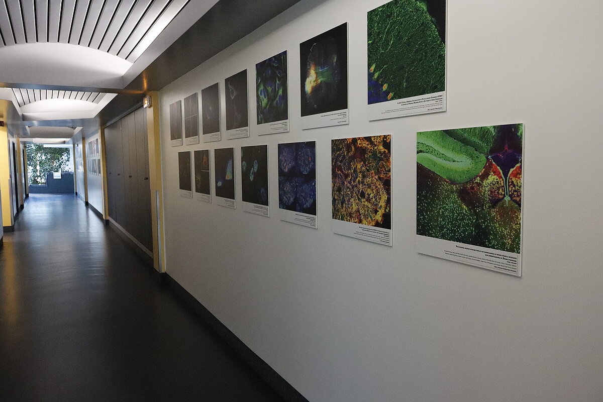 L'IGBMC affiche ses recherches | IGBMC