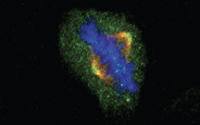 XPD, at the crossroads of repair, transcription and mitosis | IGBMC